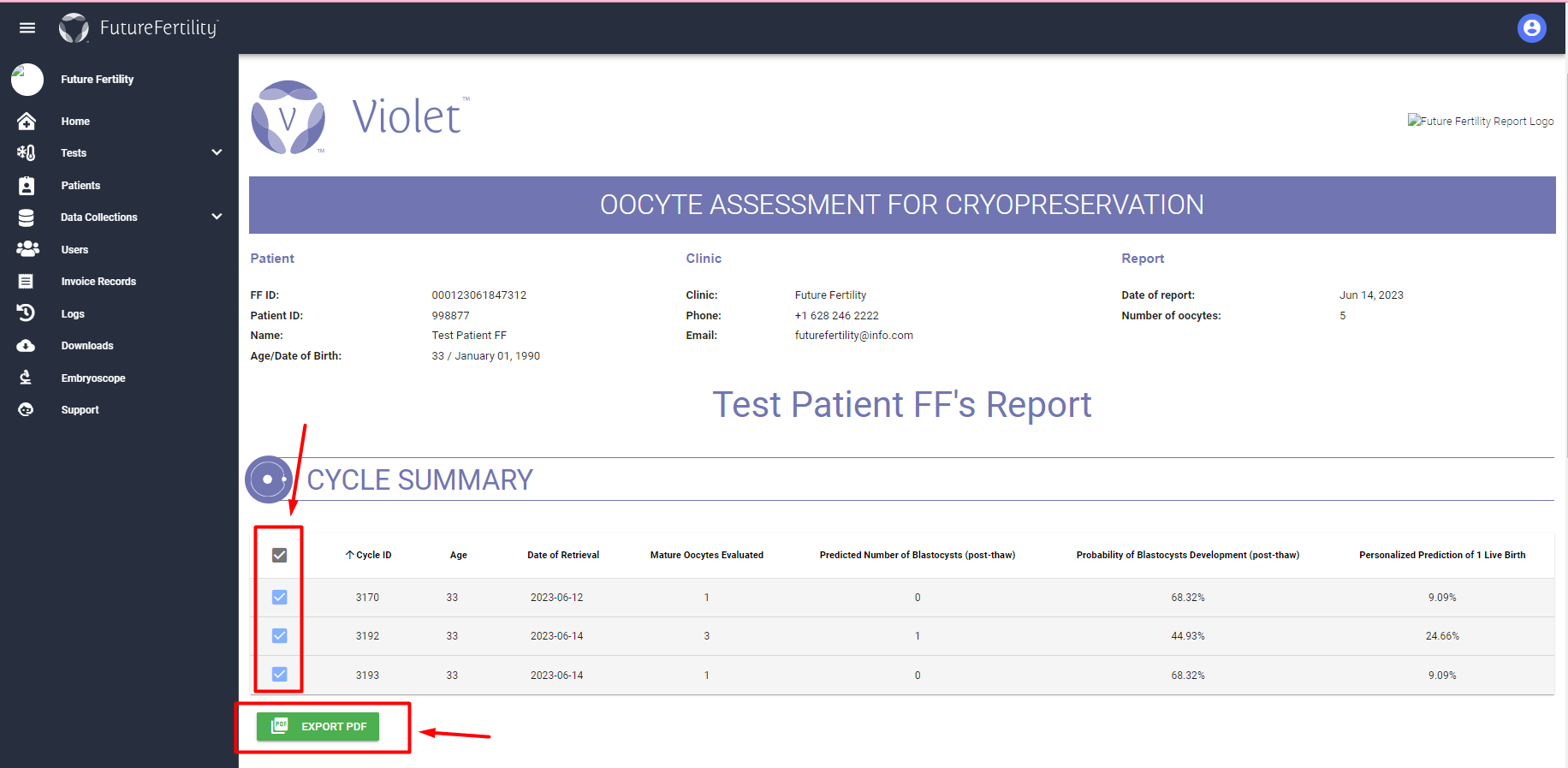 Cómo crear el informe "VIOLET Summary" – Future Fertility